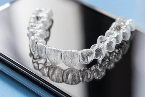 SmartTrack: do que são feitos os alinhadores Invisalign - Kátia Rie ...