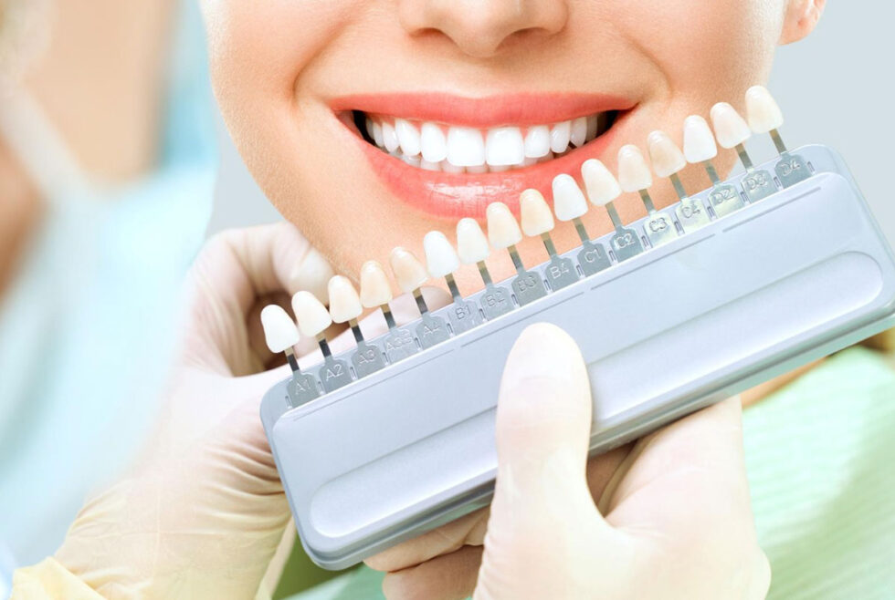 Finalizei o tratamento com Invisalign, mas meus dentes ainda não estão ...